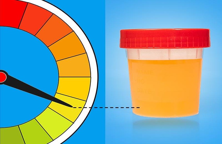 पेशाब का पीलापन बढ़ा देता है ट्यूमर का खतरा, इन आसान उपायों से समस्या ...