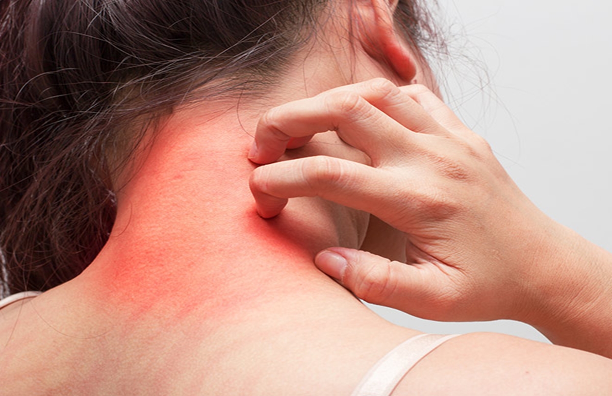 ये 5 घरेलू उपाय स्किन इंफेक्शन को दूर करने में हैं असरदार, जानिये कैसे ...