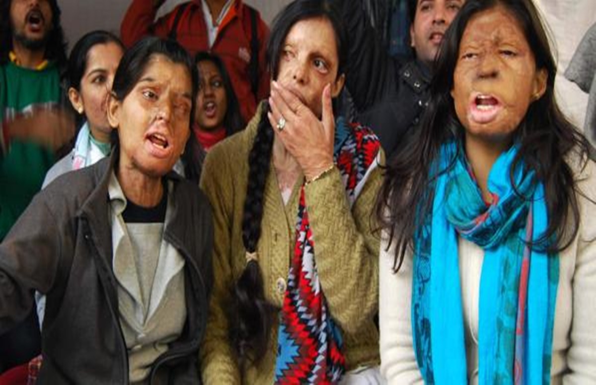 संपादकीय: तेजाब का दंश | Jansatta