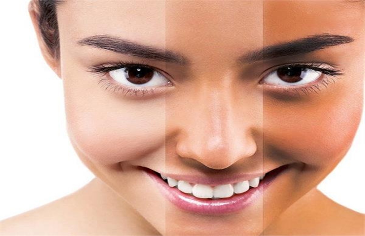 टैनिंग के कारण बदरंग हो गई है त्वचा? ये घरेलू नुस्खे दिला सकते हैं ...