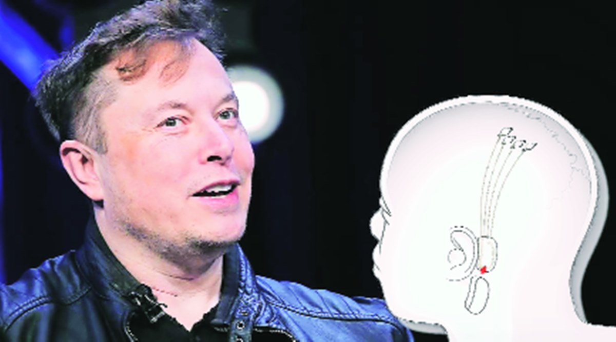 Preparing to put a chip in the human brain-इंसान के दिमाग में चिप लगाने ...