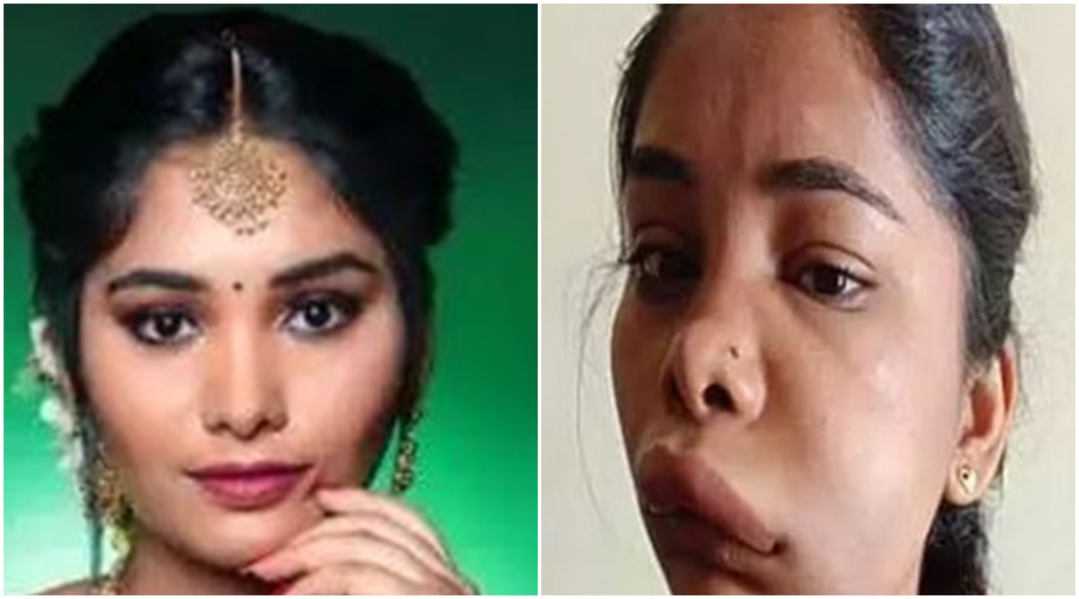 The face of kannad actress swathi satish deteriorated after surgery ...