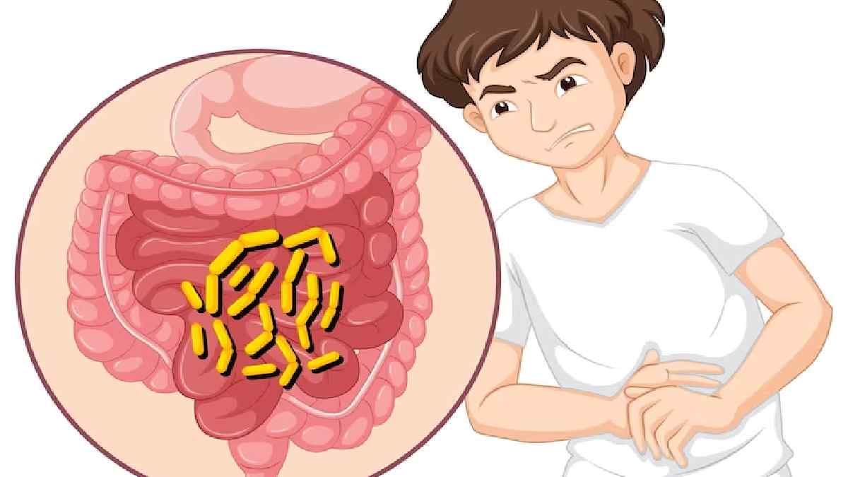 Types Of Stomach Bugs In Adults