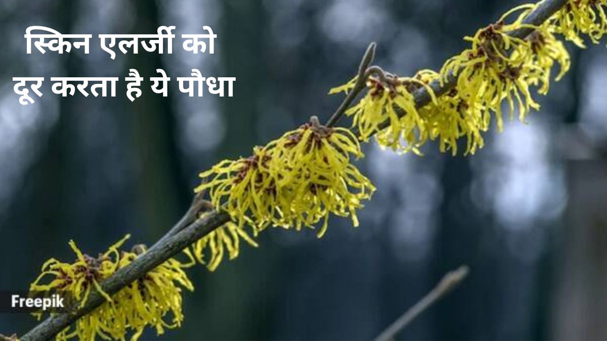 If you want to get rid of skin irritation,redness,inflammation problem ...