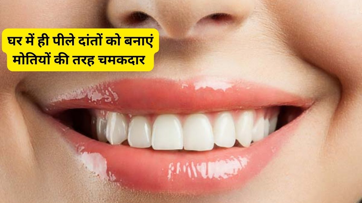 know the 3 best home remedies to get rid of Tartar In Teeth naturally ...