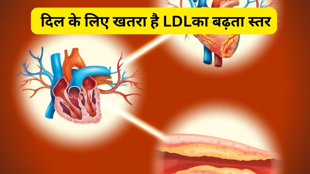 500 mg/dL cholesterol Can weakens and blocks the nerves, it can ...