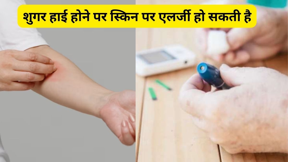 What happens to skin when blood sugar is high? 5 early sign and ...