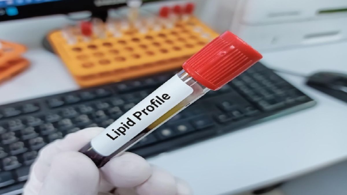 Cholesterol level has crossed the border line, so consume tulsi, this ...