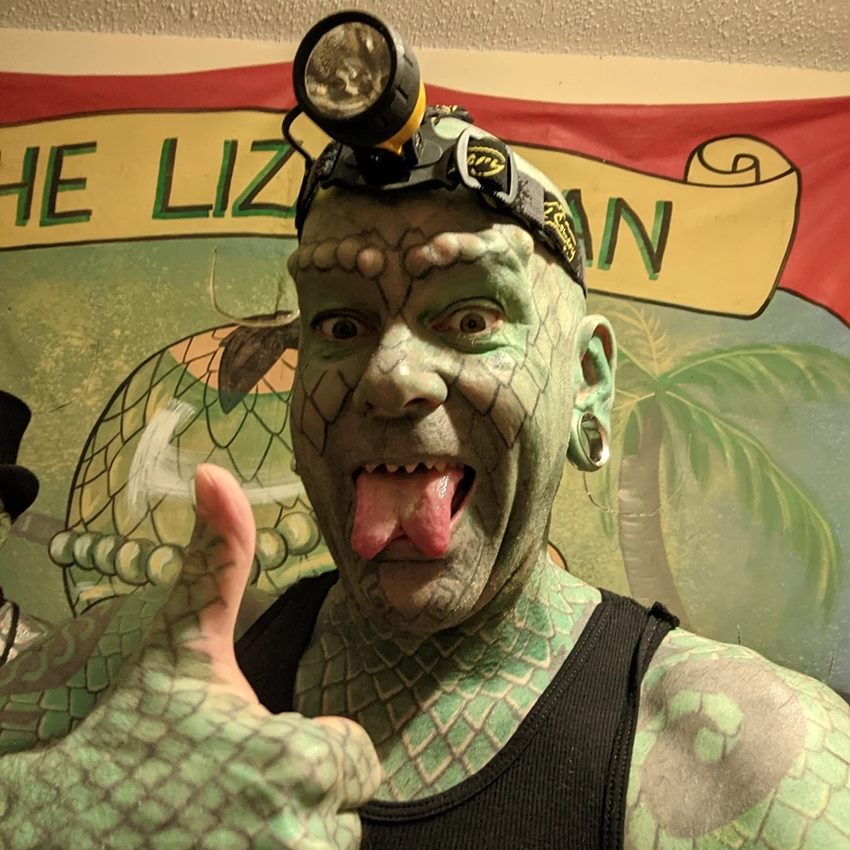 In the craze to look different, these people got strange surgeries and ...