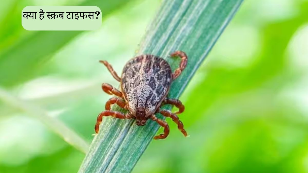 What is scrub typhus the infectious disease Know about Symptoms and how ...