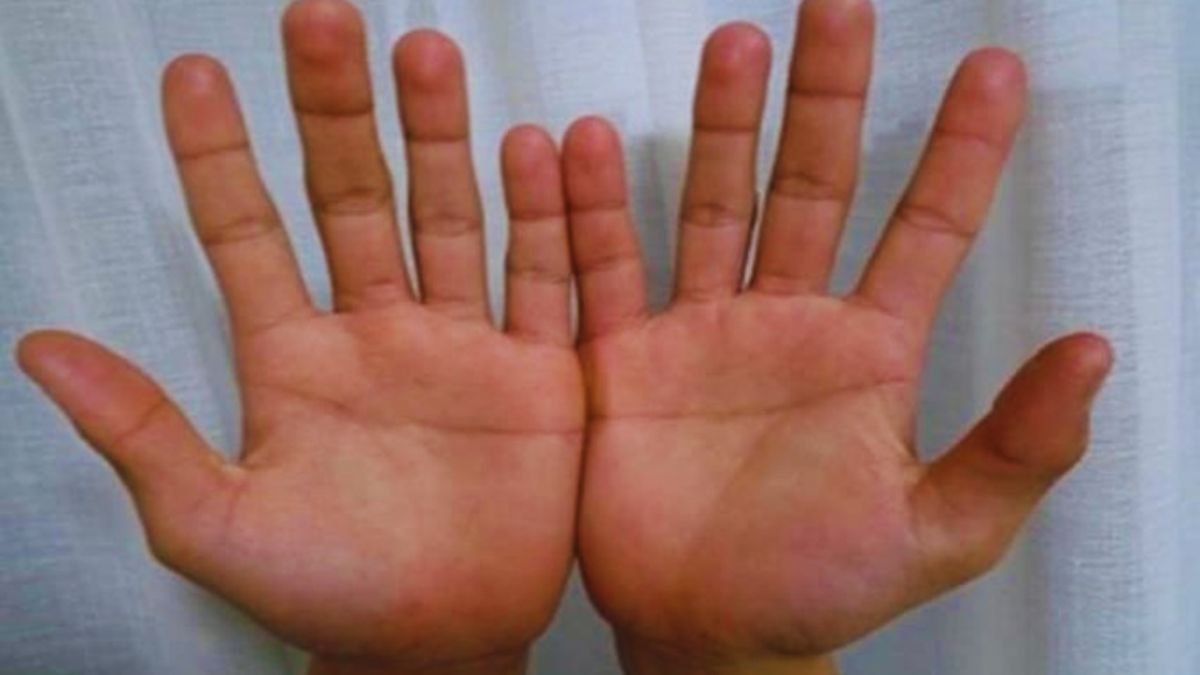 हाथ की उंगलियों पर ये निशान और रेखाएं बनाती हैं व्यक्ति को धनवान, वैभव ...