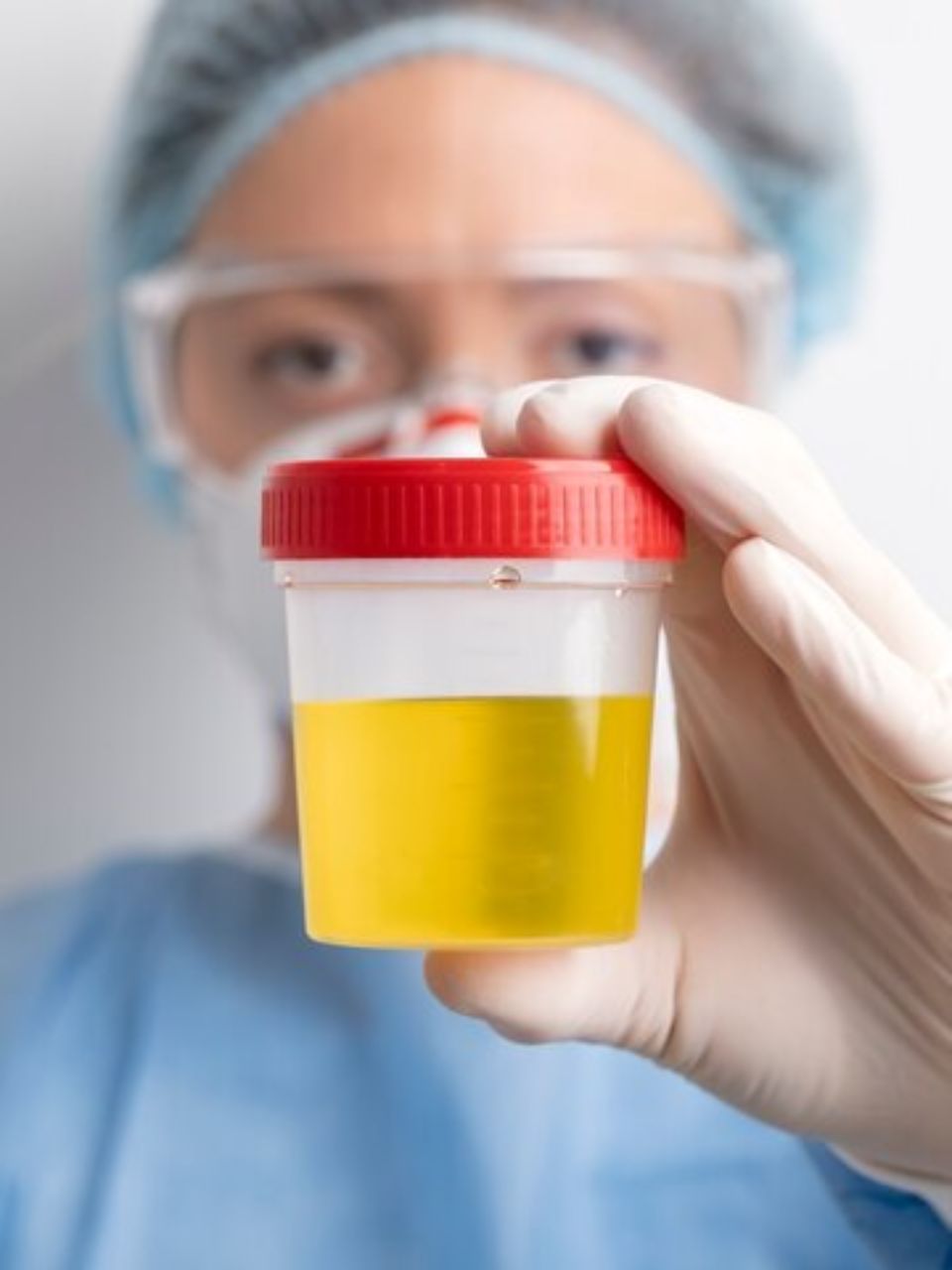 Urine Color and health sign know What color should your urine be