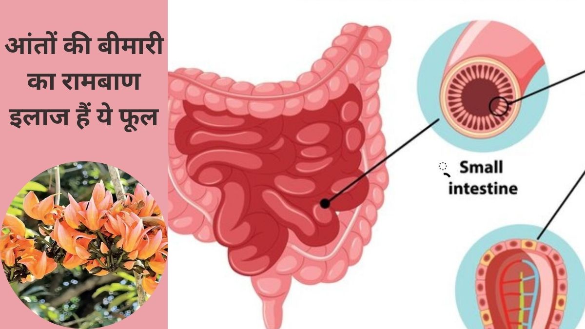 आंतों की परेशानी में लाभकारी है ये फूल, सूजन को कम करने में इस तरह करें ...