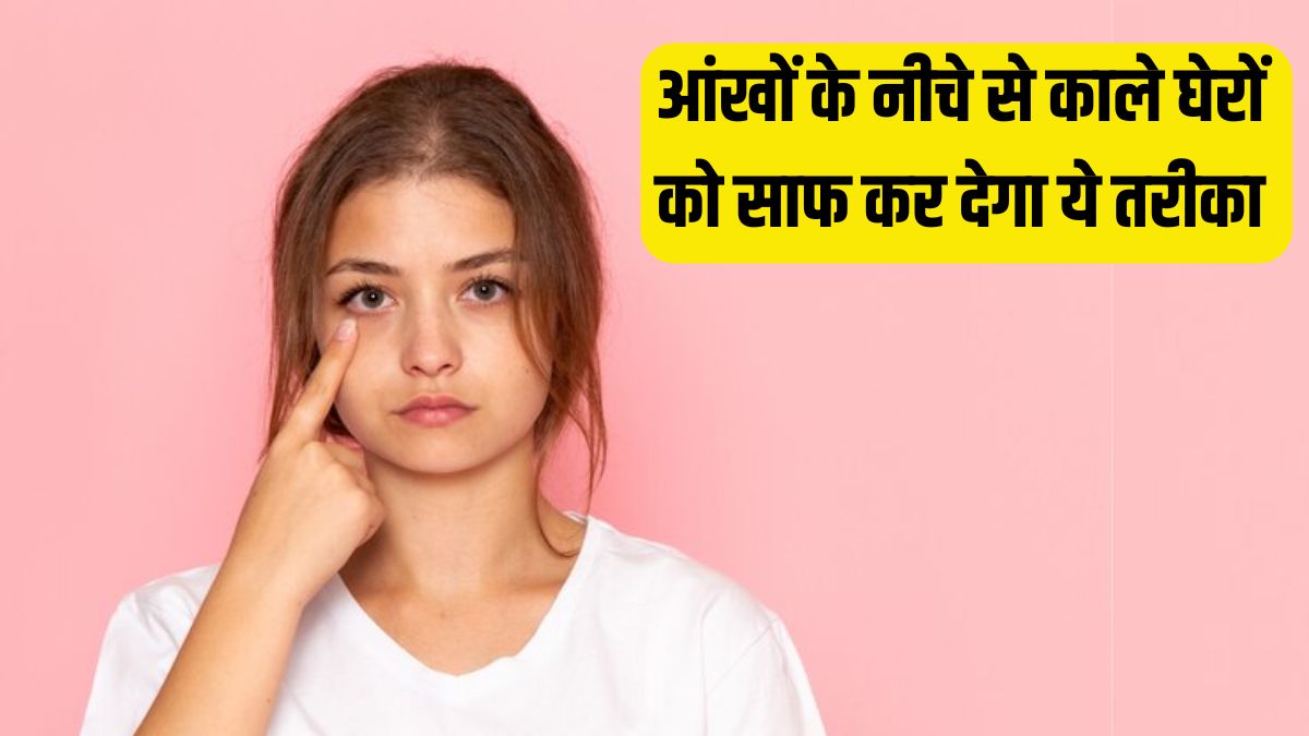 Dark Circles से डल और उम्रदराज दिखने लगा है चेहरा? महीने भर में आंखों ...