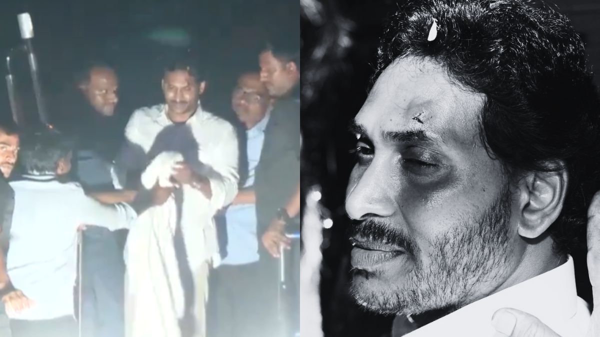 jagana-mohan-reddy-injured-head-while-elections-roadshow-stone-pelting-lok-sabha-elections-2024 ...