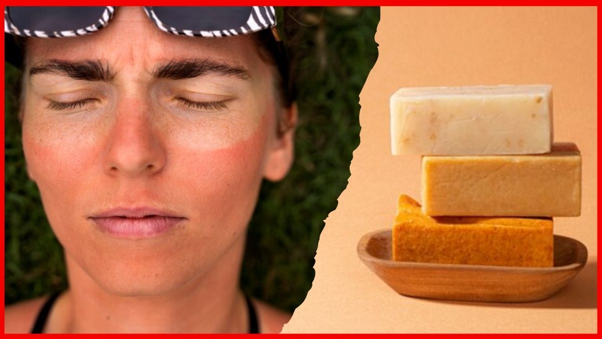 धूप की वजह से स्किन पर हो गई है टैनिंग? घर पर इन चीजों से बना लें D-tan ...