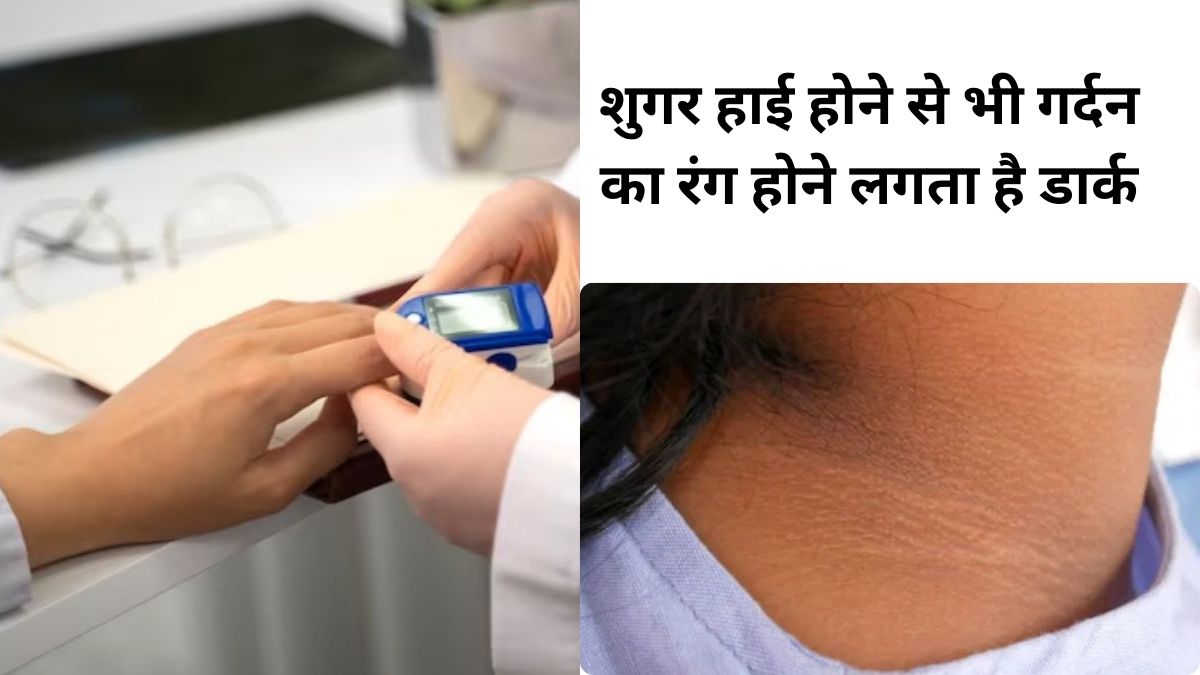 स्किन पर दिखने वाले ये 5 लक्षण बताते हैं कि आप Diabetes के हैं शिकार ...