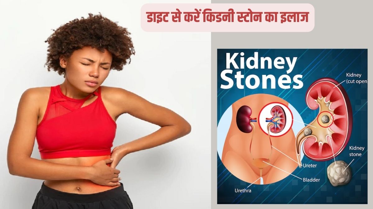 पीठ के निचले हिस्से, पेट या बाजू में दर्द Kidney Stone के हो सकते हैं ...