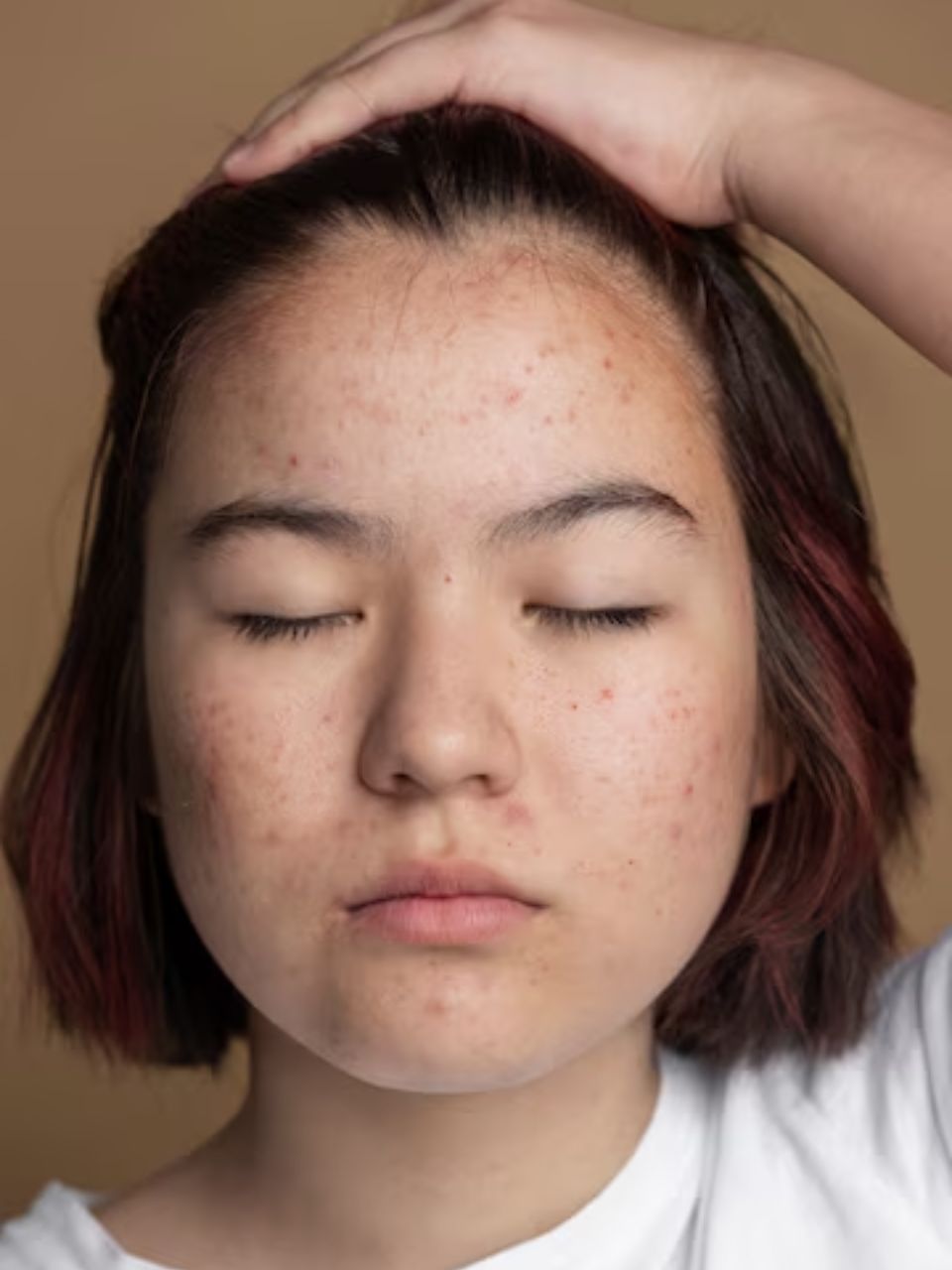 4 major symptoms on your face can be a sign of serious disease