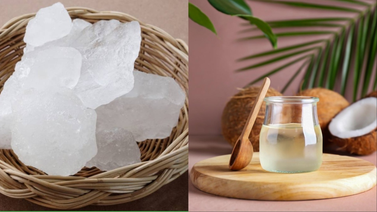 Coconut oil and fitkari: नहीं जा रहा आपके बालों से डैंड्रफ? नारियल तेल ...