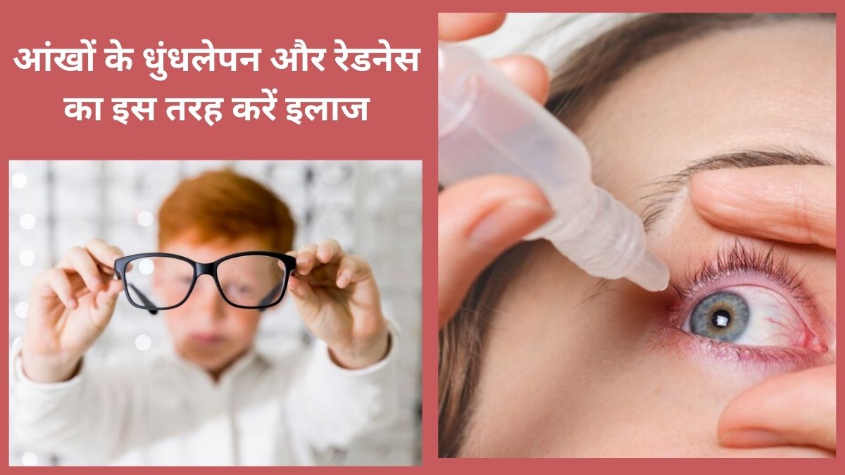 आंखों में खुजली हो रही है और टप-टप टपक रहा है पानी, सीजनल एलर्जी के हो ...