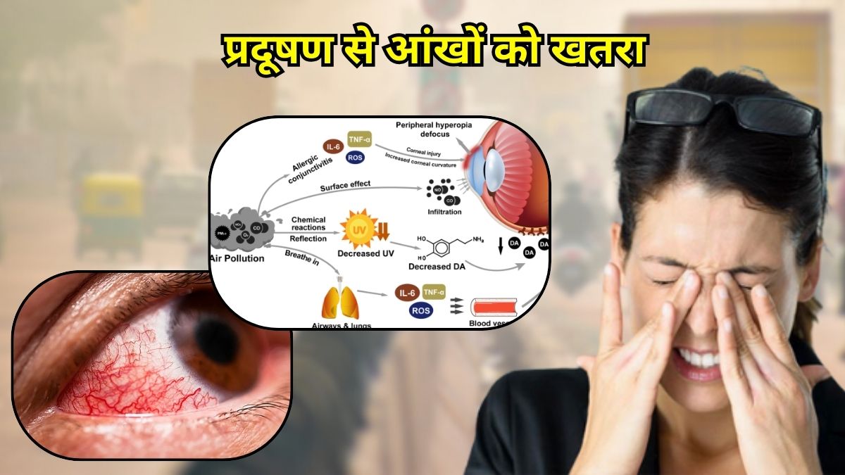 Eye Care Tips: बढ़ते प्रदूषण से आंखों में हो रही जलन जैसी समस्या ...