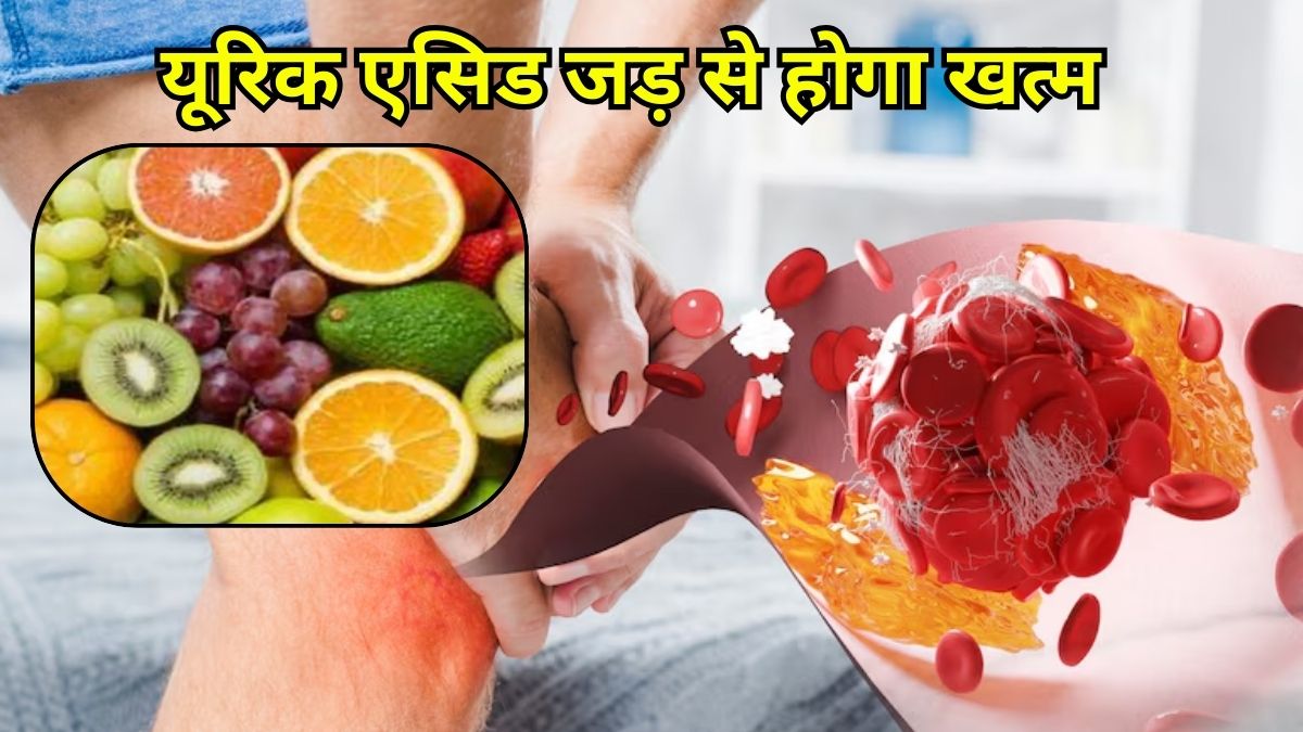 Fruit For Uric Acid Control: इन 3 फलों के सेवन से कभी नहीं बढ़ेगा यूरिक ...