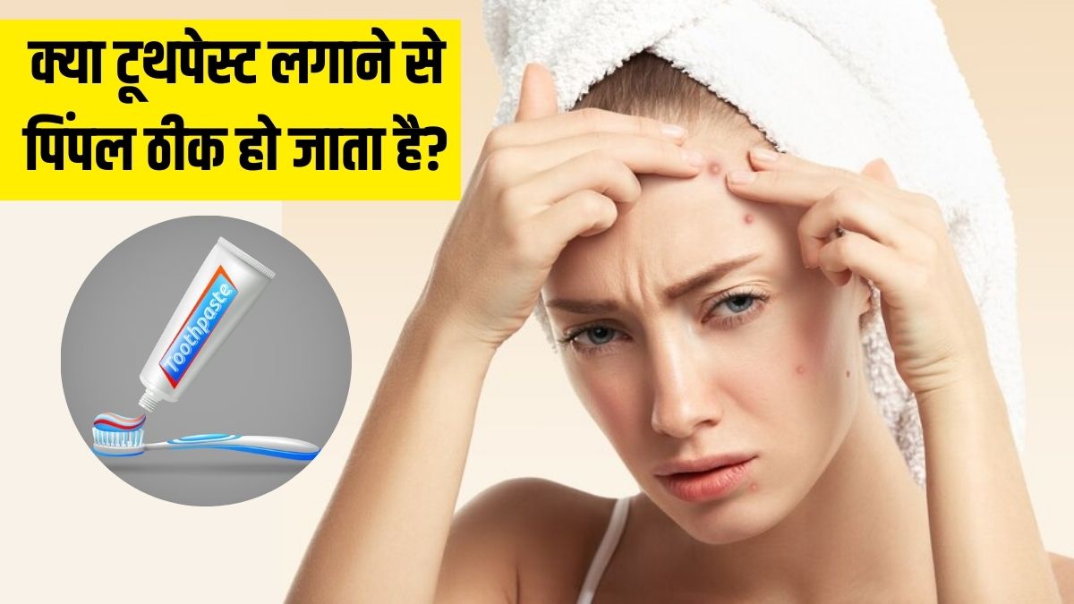 क्या टूथपेस्ट लगाने से पिंपल्स ठीक हो जाते हैं? सेलिब्रिटी ...