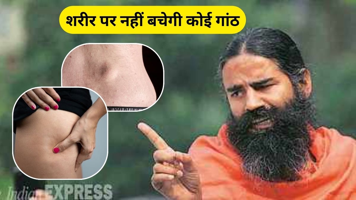 Ganth Ka Ilaj: शरीर से सारी गांठ खत्म कर देगा ये आयुर्वेदिक इलाज, बाबा ...