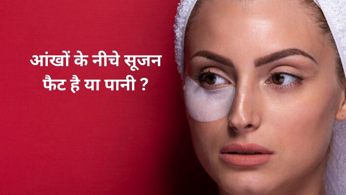 इन 5 बीमारियों की वजह से आंखों के नीचे आती है सूजन, पपोटे में हर वक्त ...