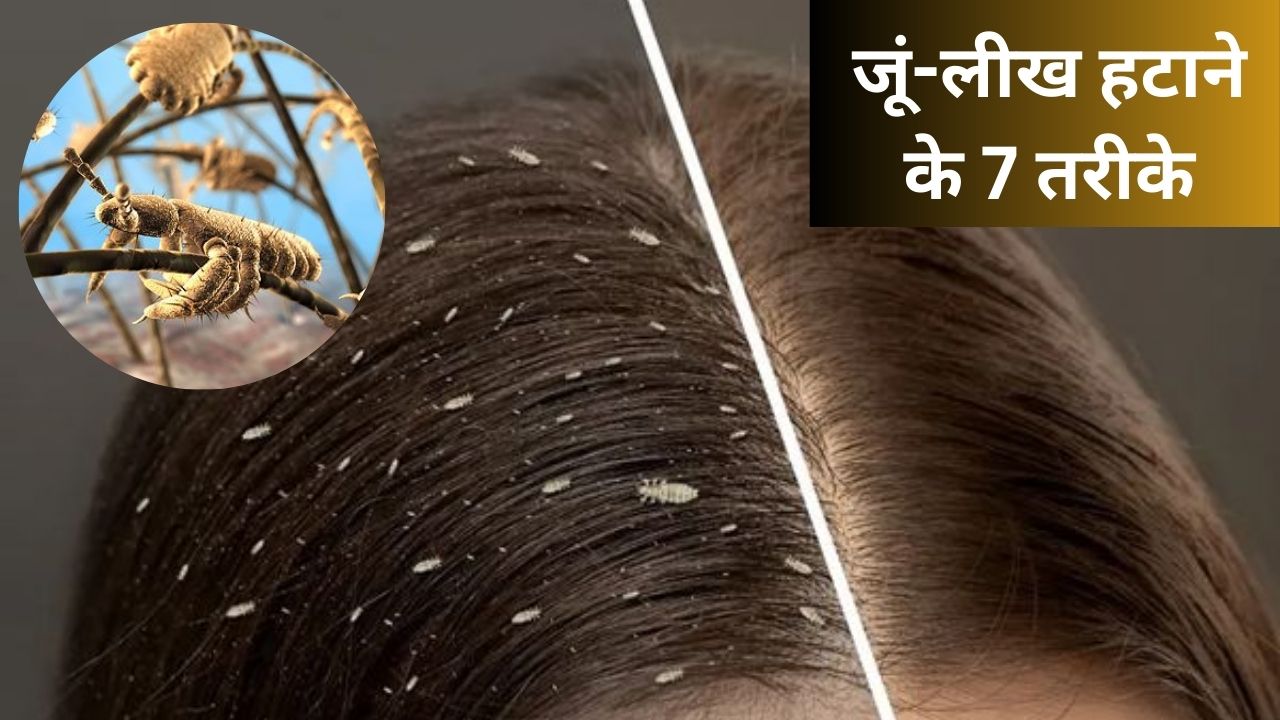 7 ways to remove lice and nits from hair due to sweat stickiness in ...